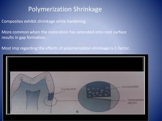 Composite resin restoration in dentistry | PPT