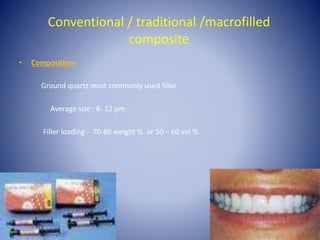 Composite resin restoration in dentistry | PPT