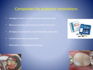 Composite resin restoration in dentistry | PPT