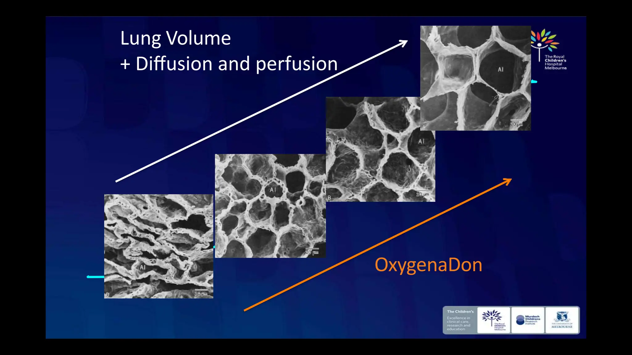 Basic Concepts -Neo Ventilation.pptx