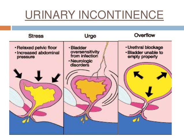 Basic concepts in urogynaecology