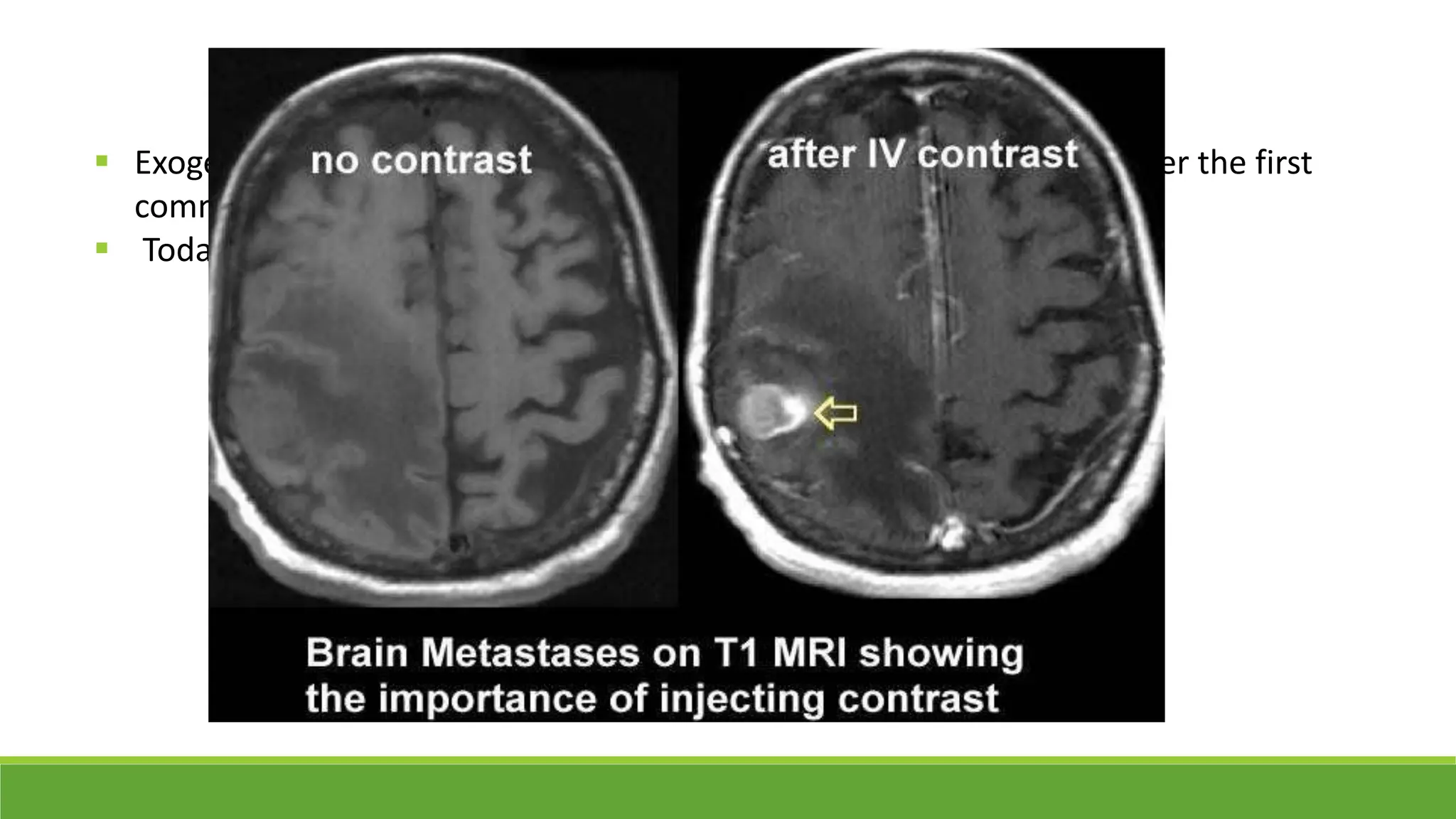 Basic contrast media used in MRI.pptxsarita gaire | PPT