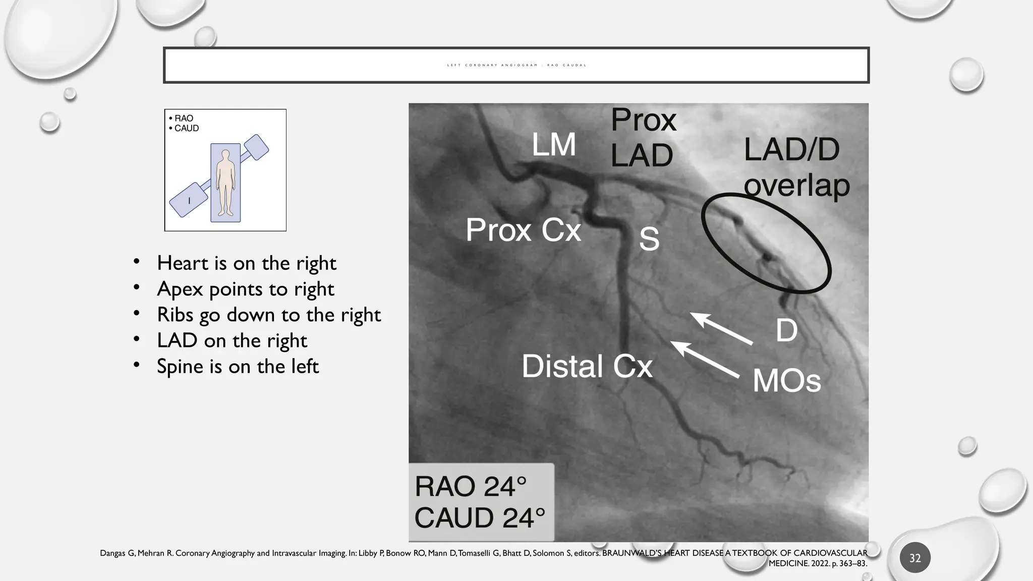 Basic Coro Angiography in cardiology interventional how to deal with it ...