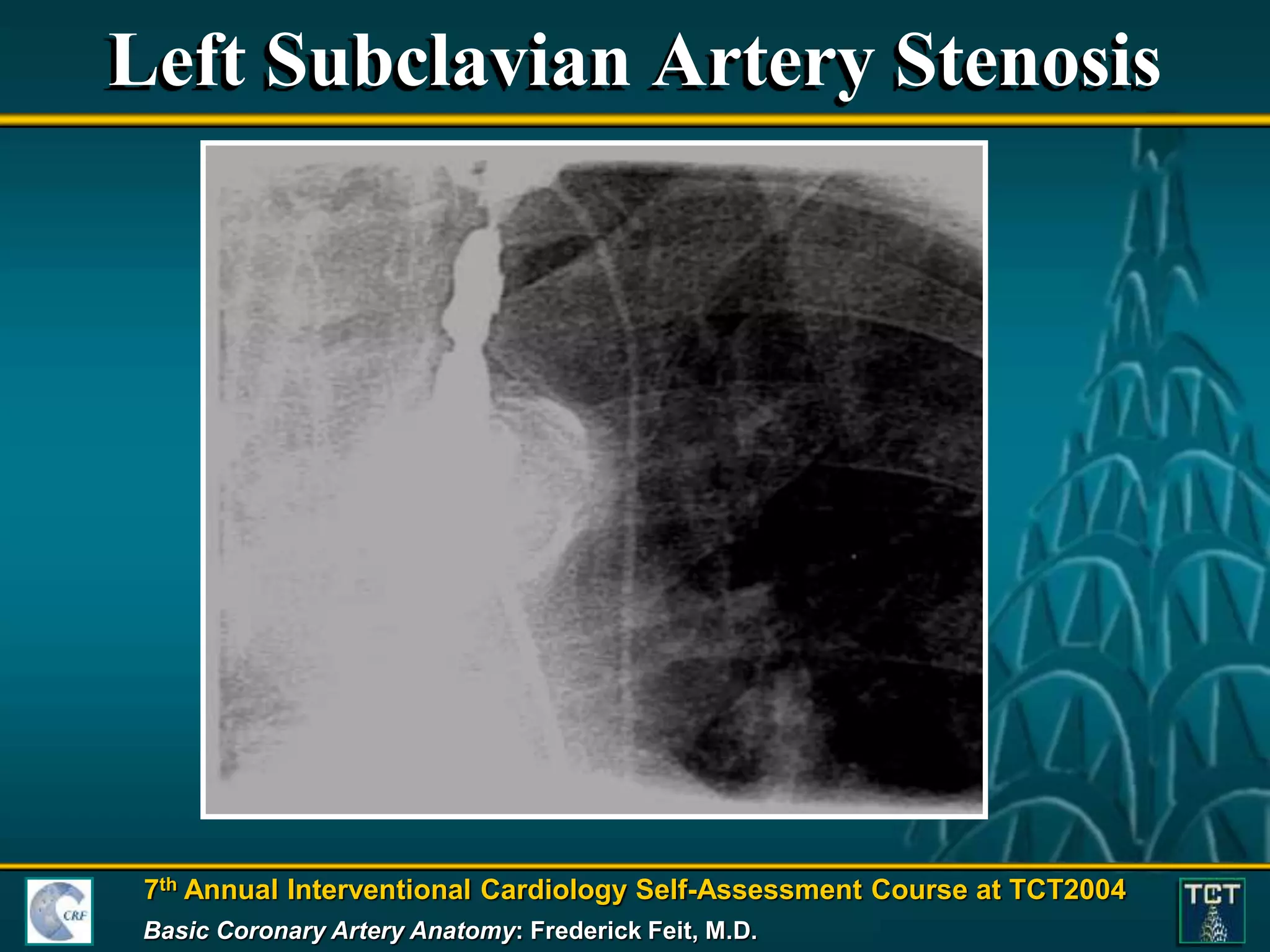 Basic Coronary Anatomy - Paul Fefer, MD..ppt