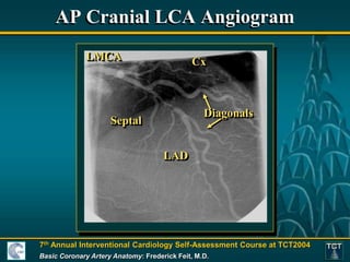 Basic Coronary Anatomy - Paul Fefer, MD..ppt