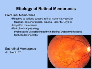 Pathology of Retina and Vitreous | PPTX