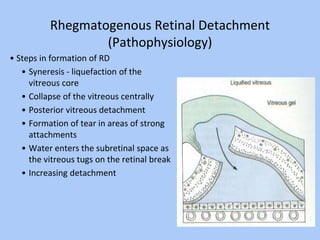 Pathology of Retina and Vitreous | PPTX