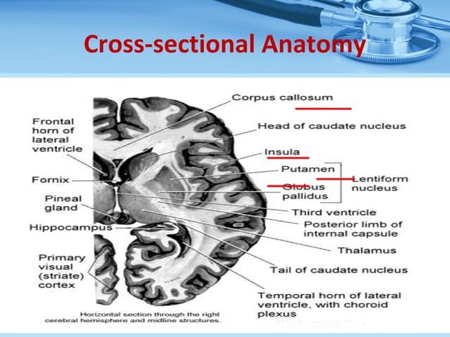 Basic ct brain and rapid CT interpretation | PPT