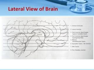 Basic ct brain and rapid CT interpretation | PPT