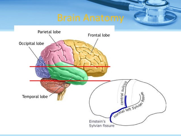 Basic ct brain and rapid CT interpretation | PPT