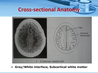 Basic ct brain and rapid CT interpretation | PPT