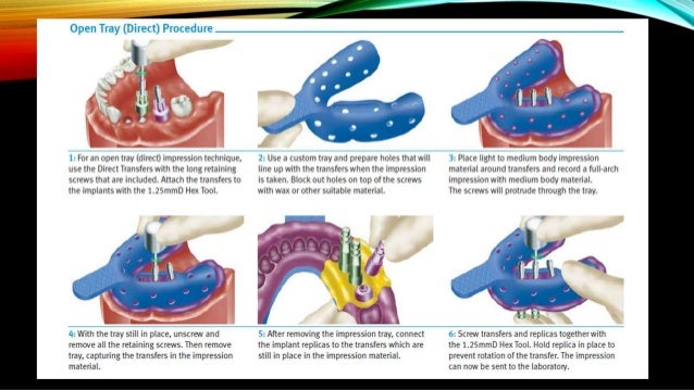 Basic dental implant