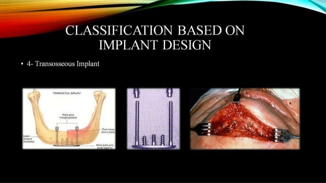 Basic dental implant