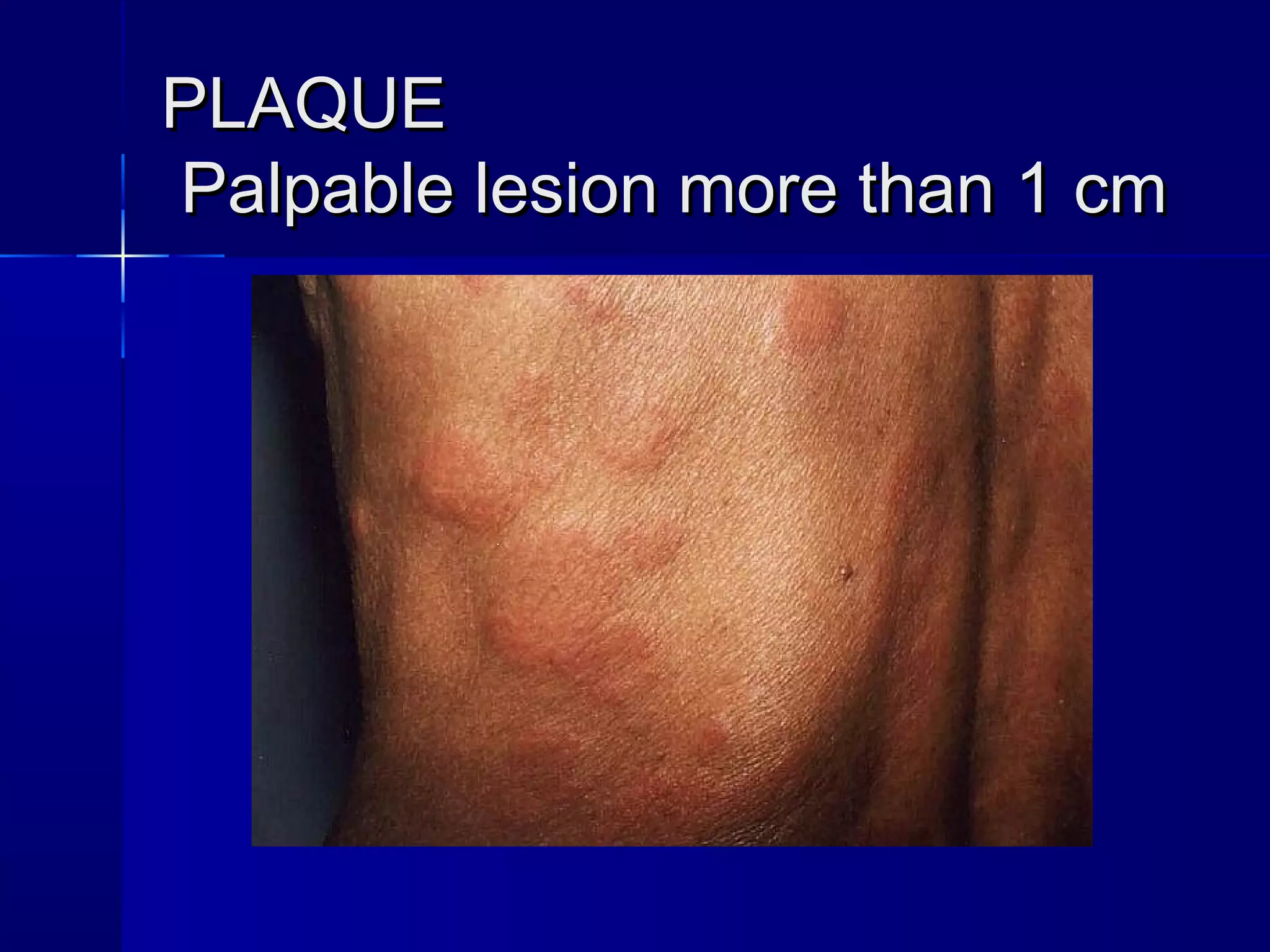 Basic dermatology by Dr. Haseeb Ahmed | PPT