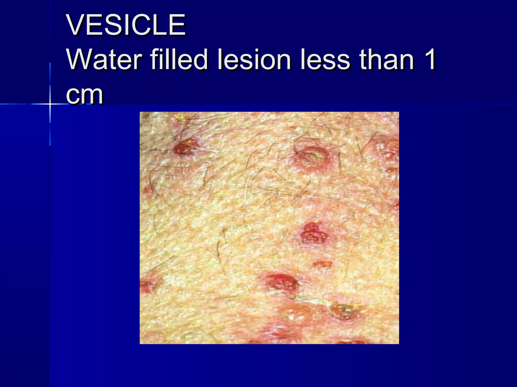 Basic dermatology by Dr. Haseeb Ahmed | PPT