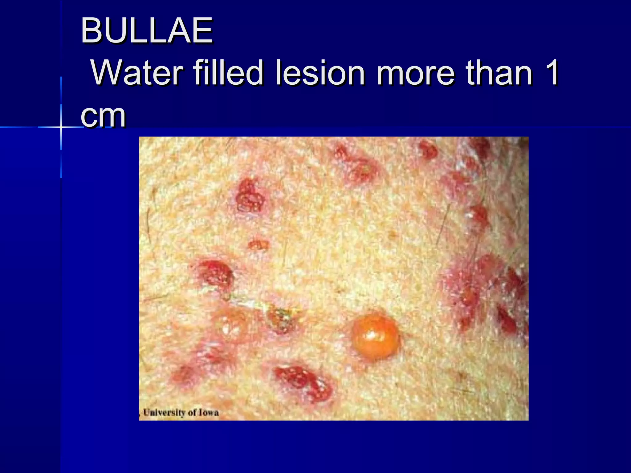 Basic dermatology by Dr. Haseeb Ahmed | PPT