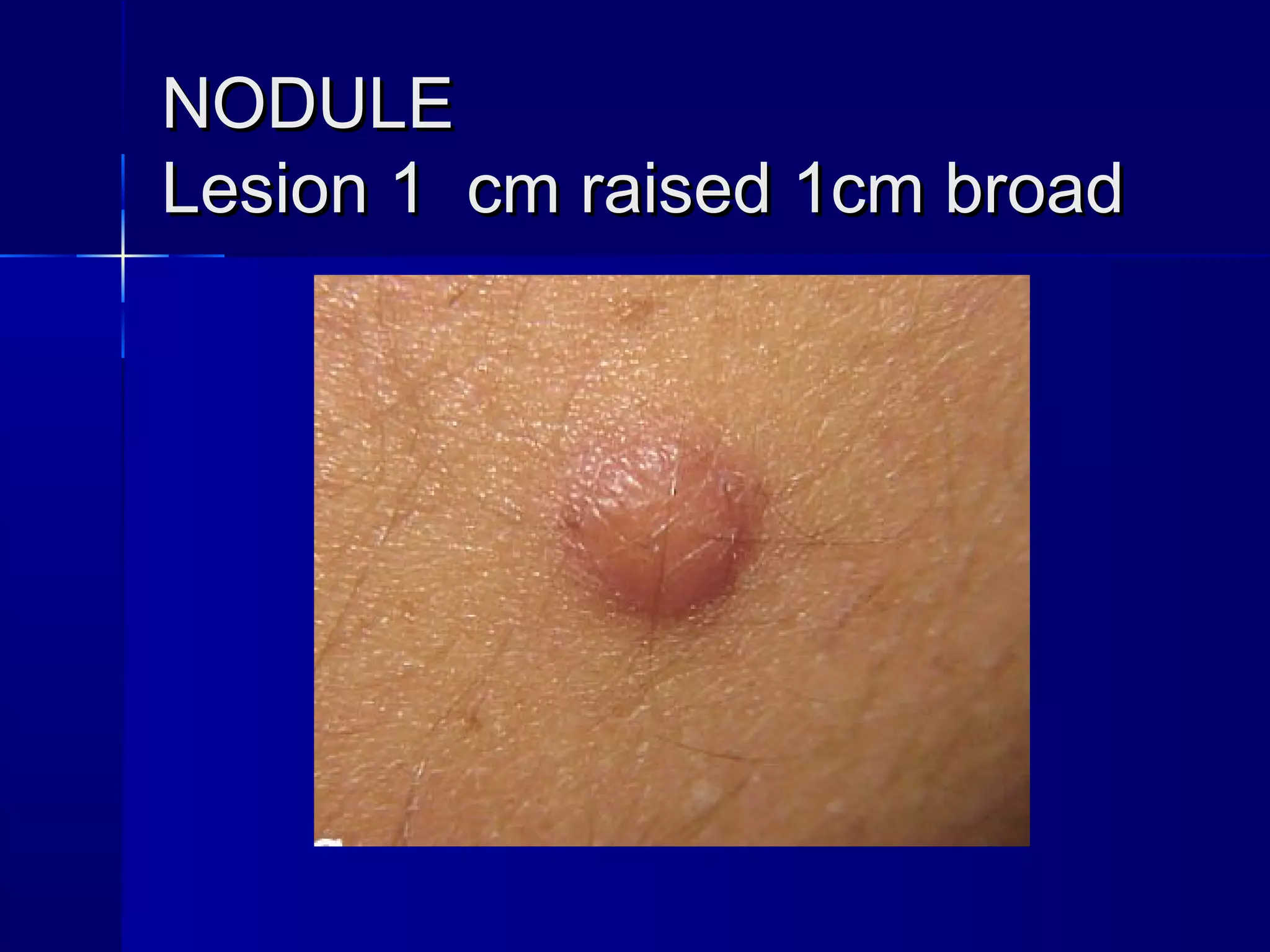 Basic dermatology by Dr. Haseeb Ahmed | PPT