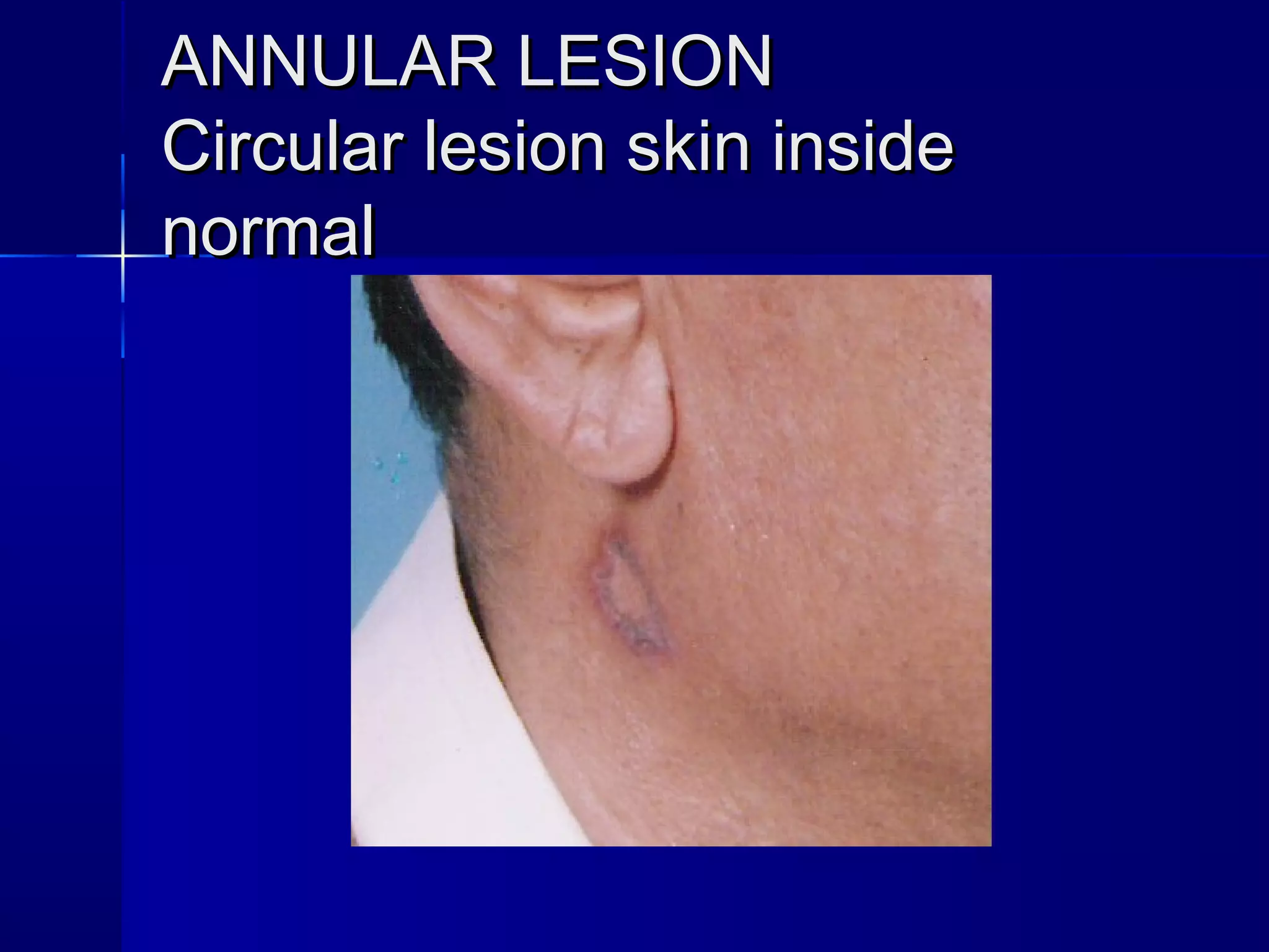 Basic dermatology by Dr. Haseeb Ahmed | PPT