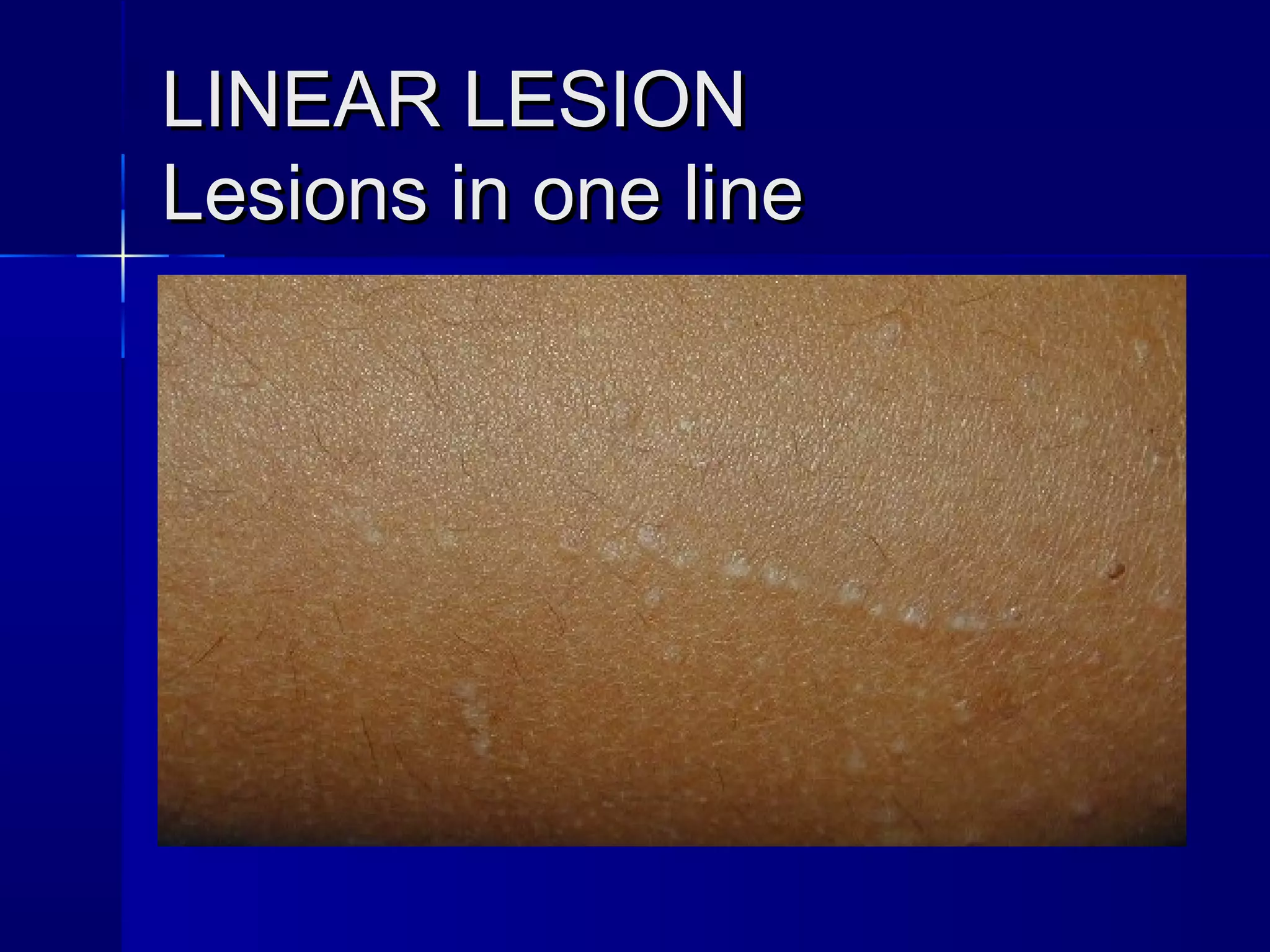 Basic dermatology by Dr. Haseeb Ahmed | PPT