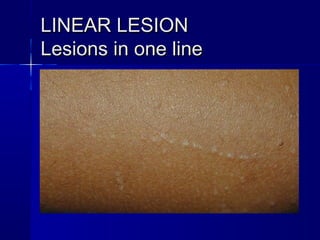 Basic dermatology by Dr. Haseeb Ahmed | PPT