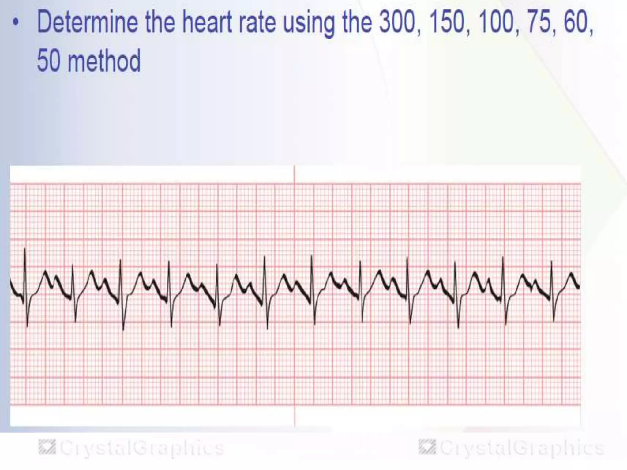 Basic dysrhythmia interpretation | PPTX