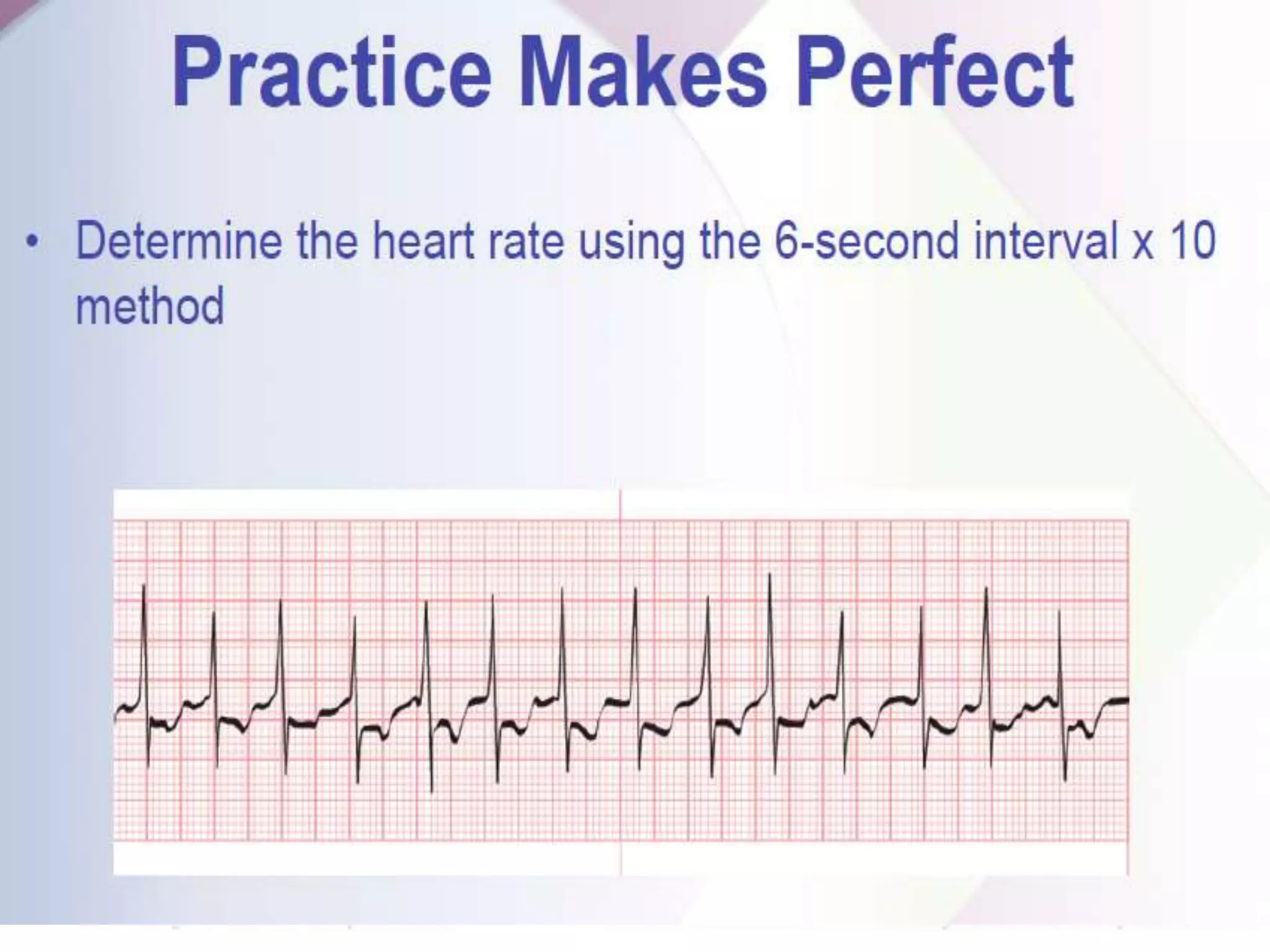 Basic dysrhythmia interpretation | PPTX