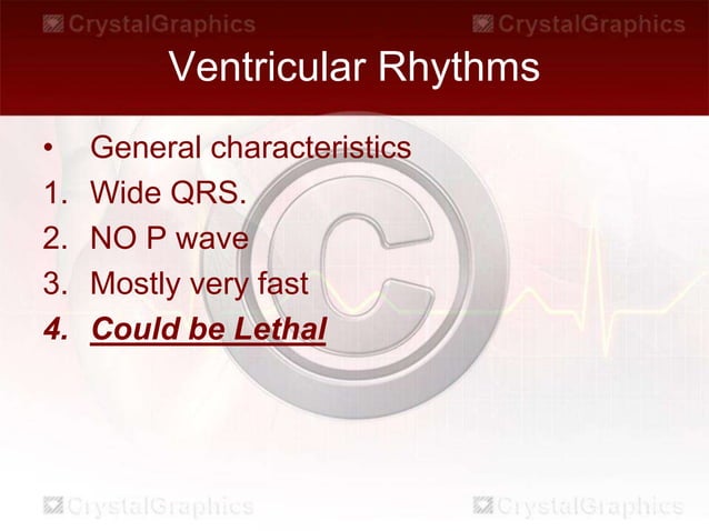Basic dysrhythmia interpretation | PPTX | Heart and Cardiovascular ...