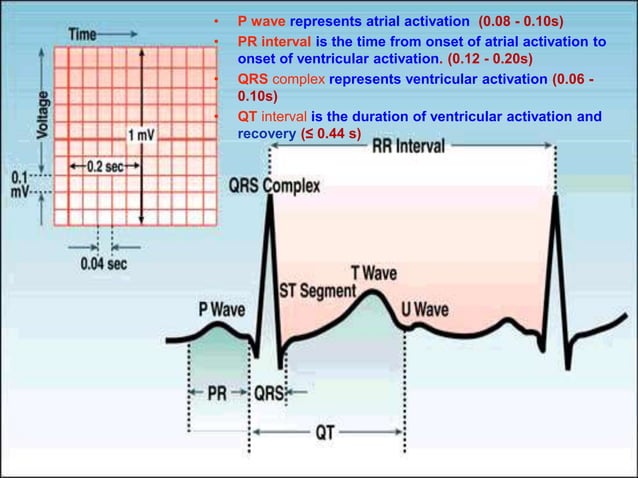 Basic dysrhythmia interpretation | PPTX | Heart and Cardiovascular ...