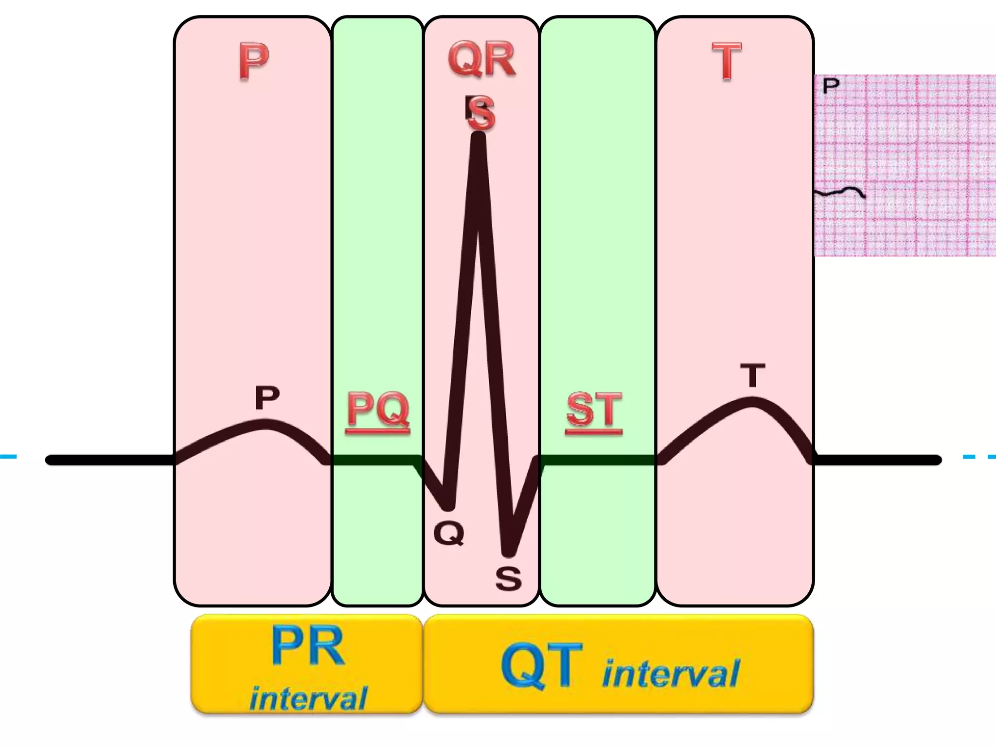 Basic ecg | PPT