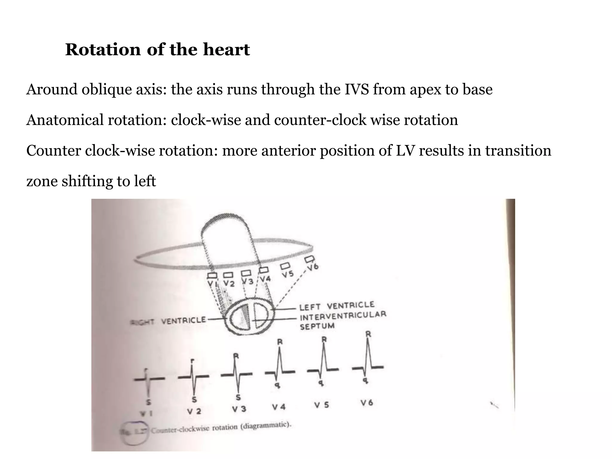 Basic ecg | PPT