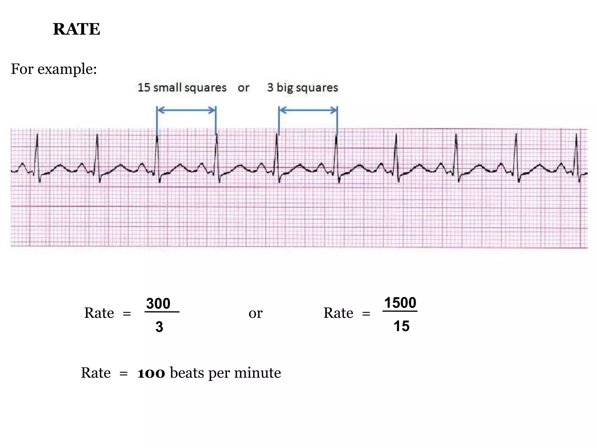 Basic ecg | PPT