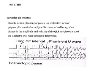 Basic ecg | PPTX