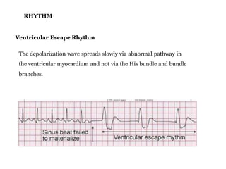 Basic ecg | PPTX