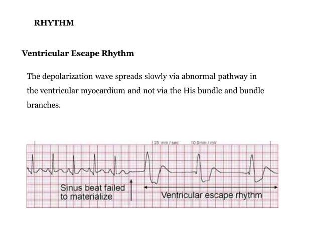 Basic ecg | PPT