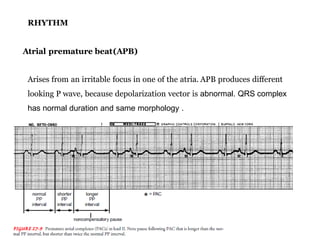 Basic ecg | PPTX