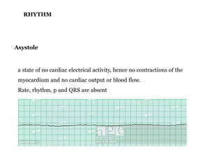 Basic ecg | PPTX