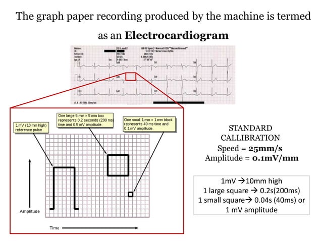 Basic ecg | PPT
