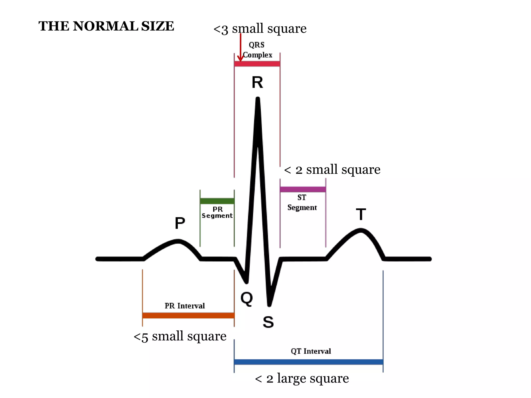 Basic ecg | PPTX