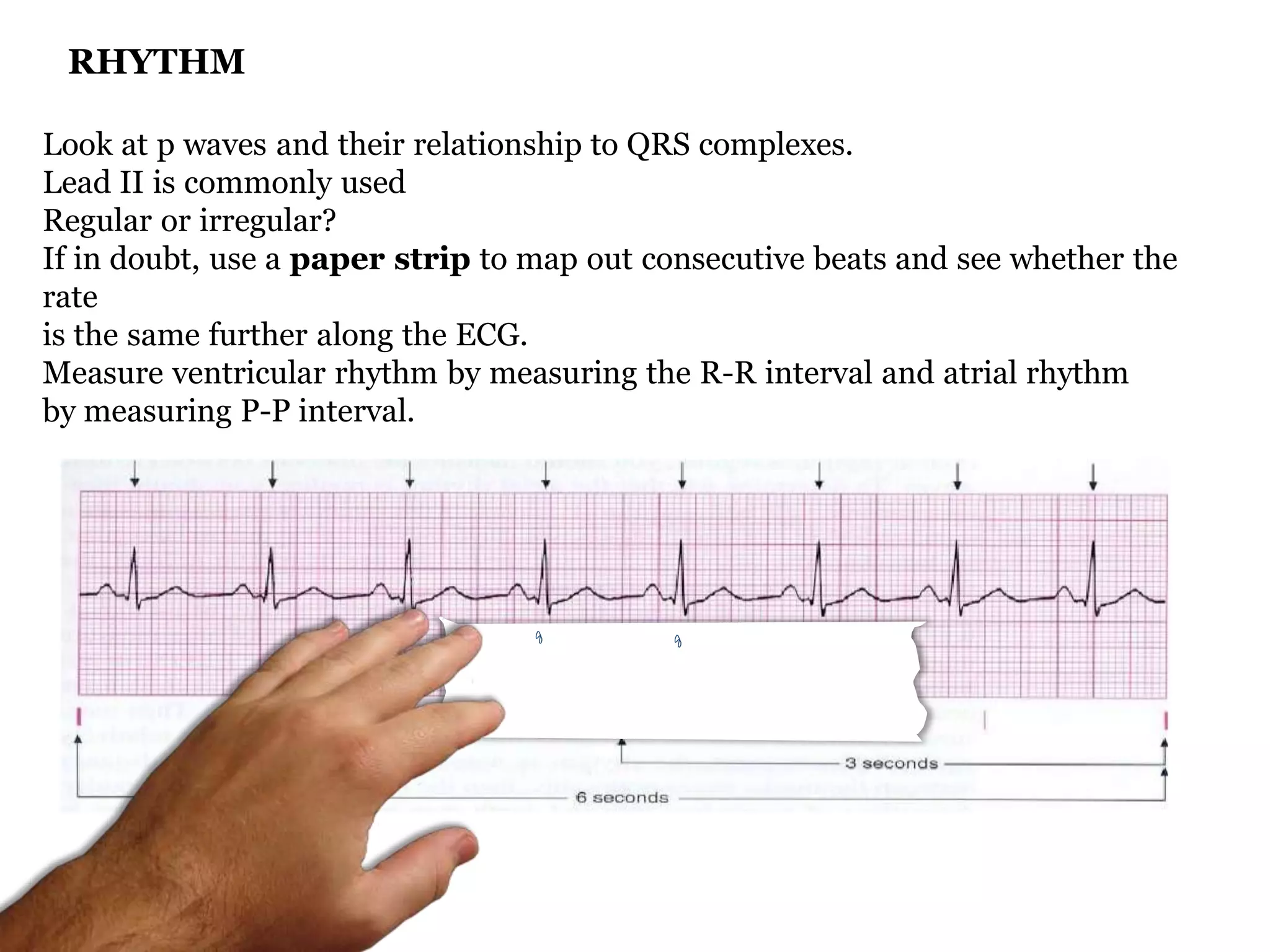 Basic ecg | PPTX