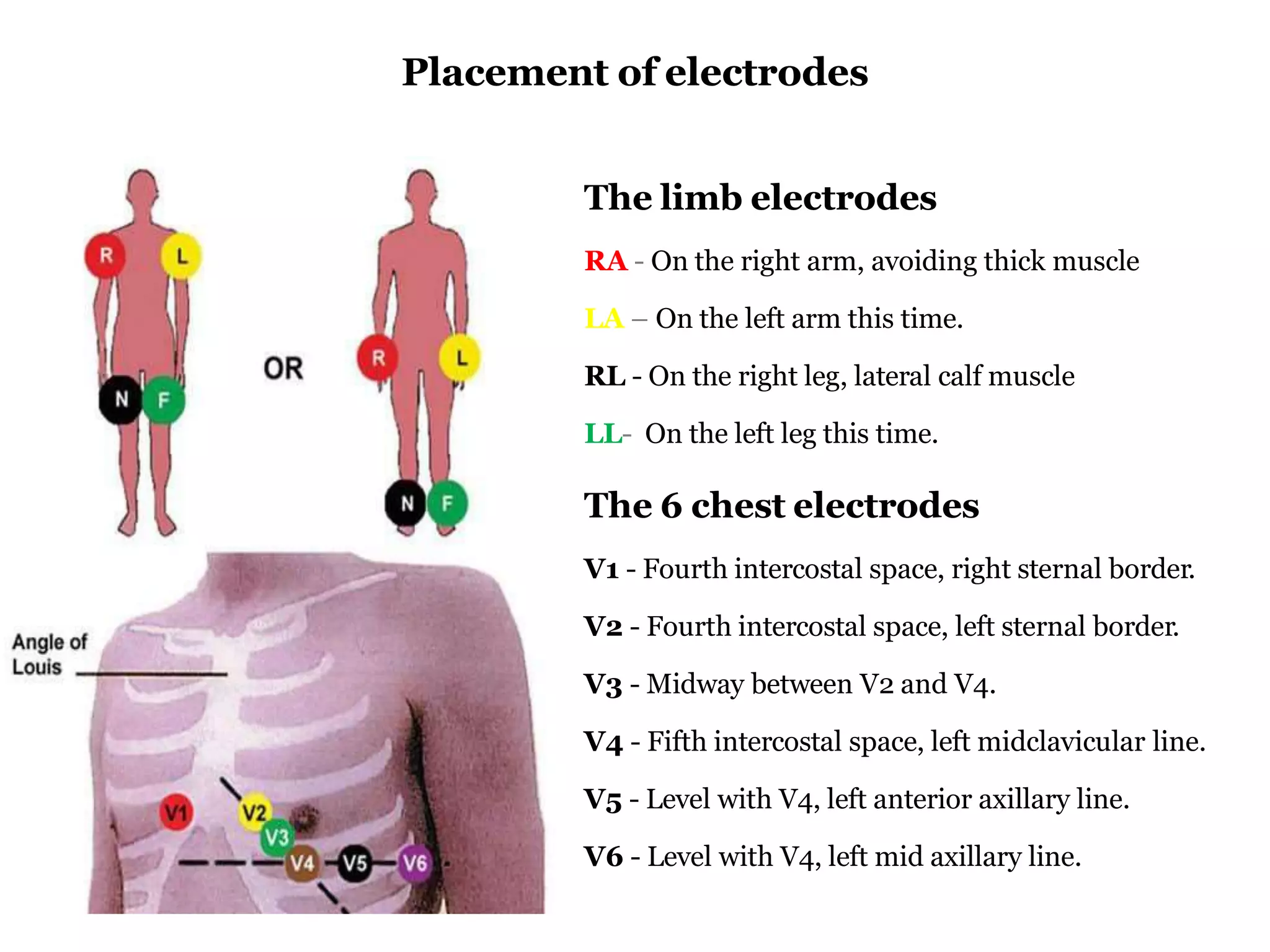 Basic ecg | PPTX