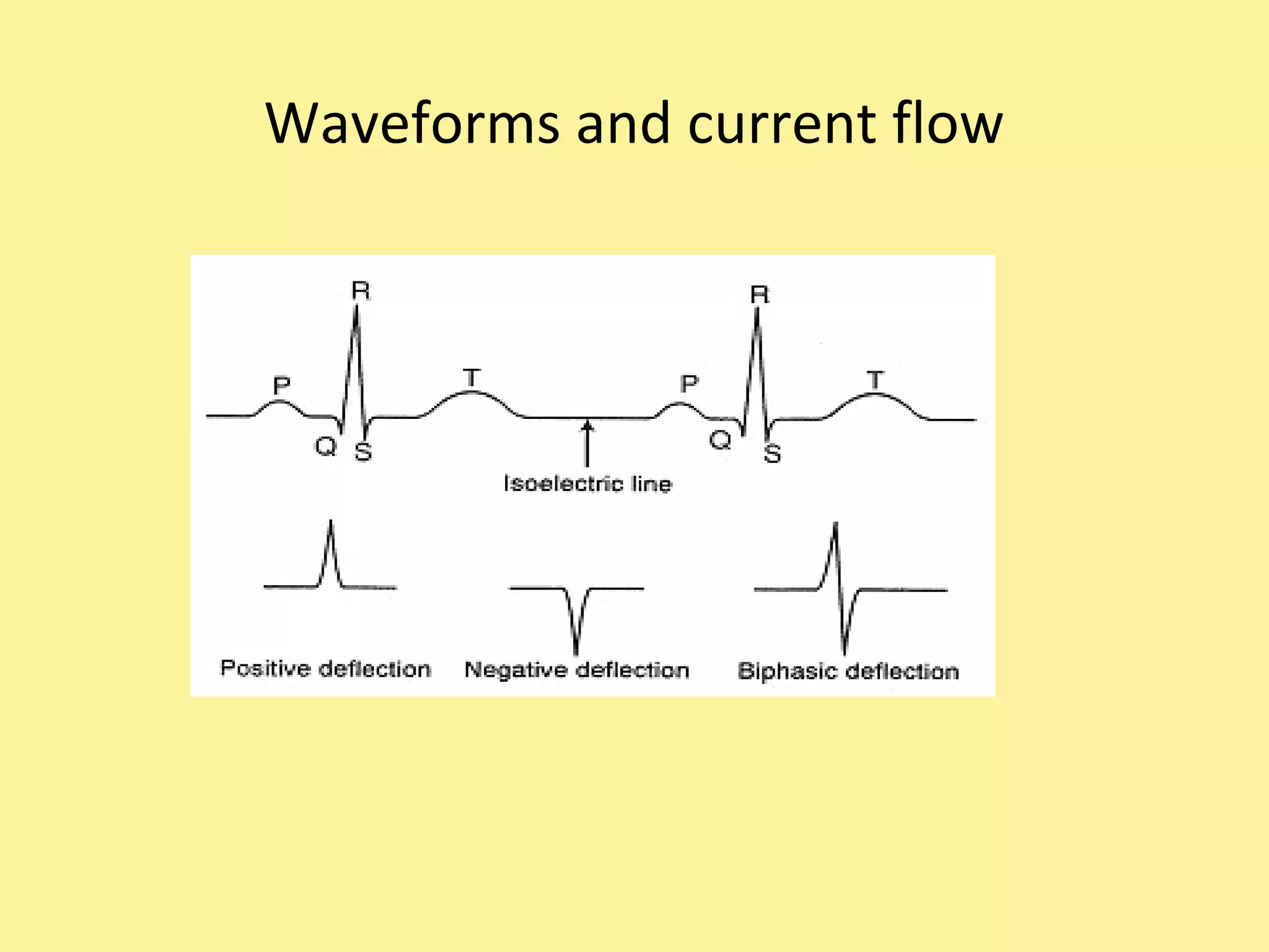 Basic ECG | PPT