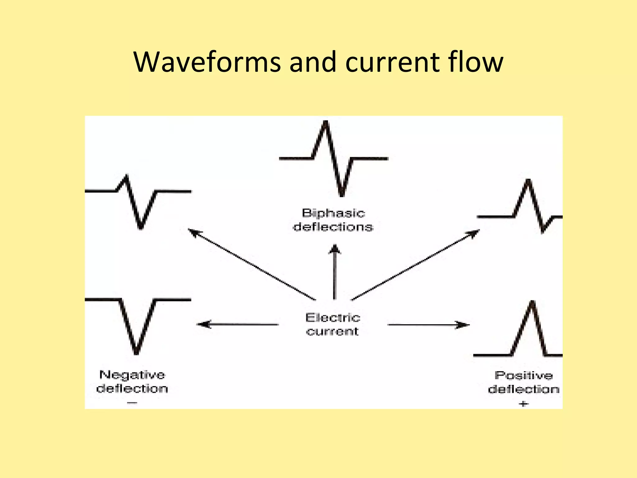Basic ECG | PPT