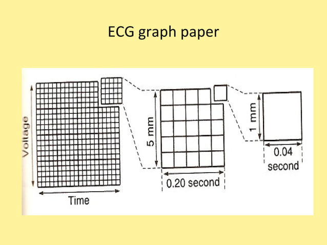 Basic ECG | PPT
