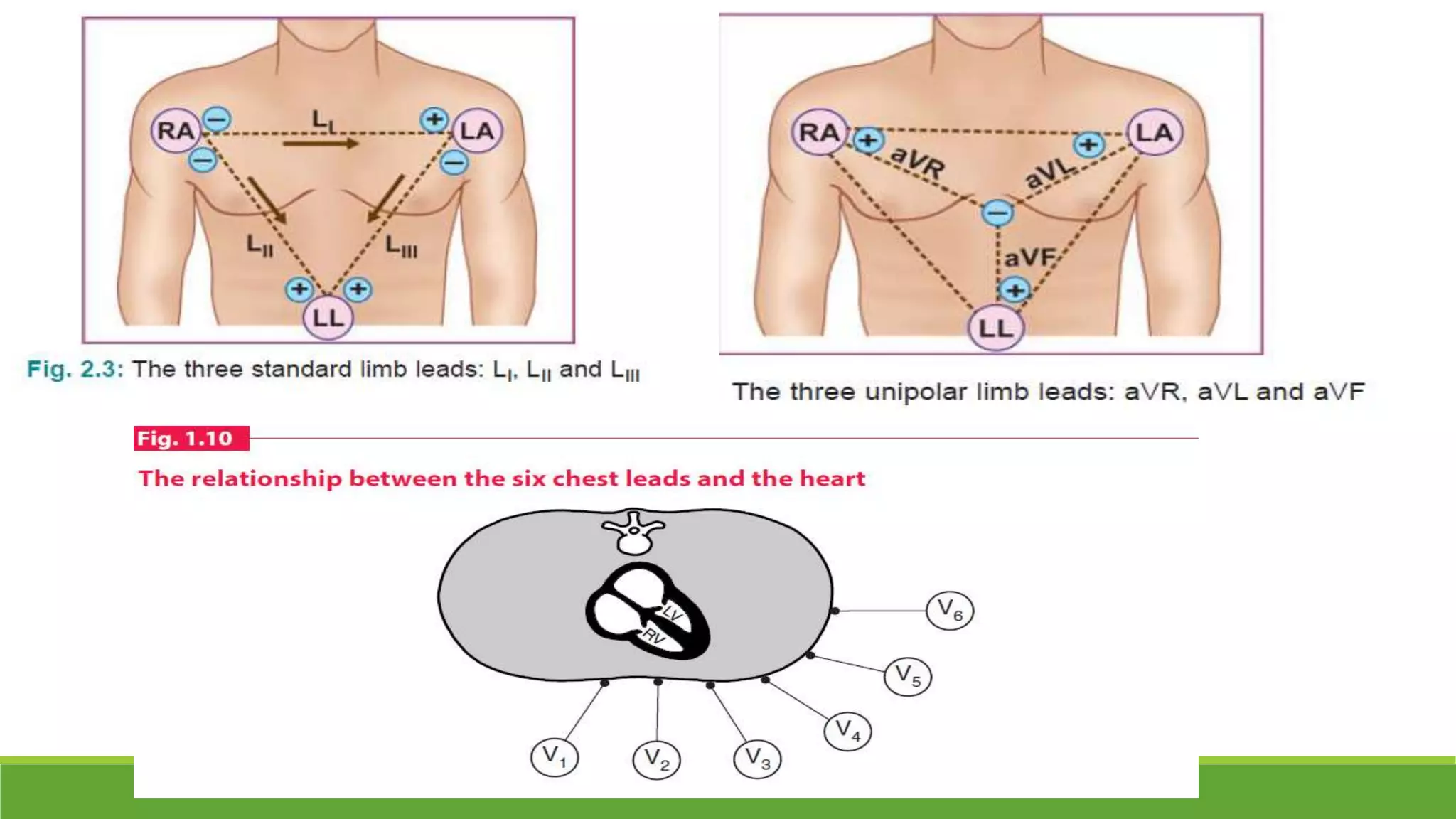 Basic ecg | PPTX