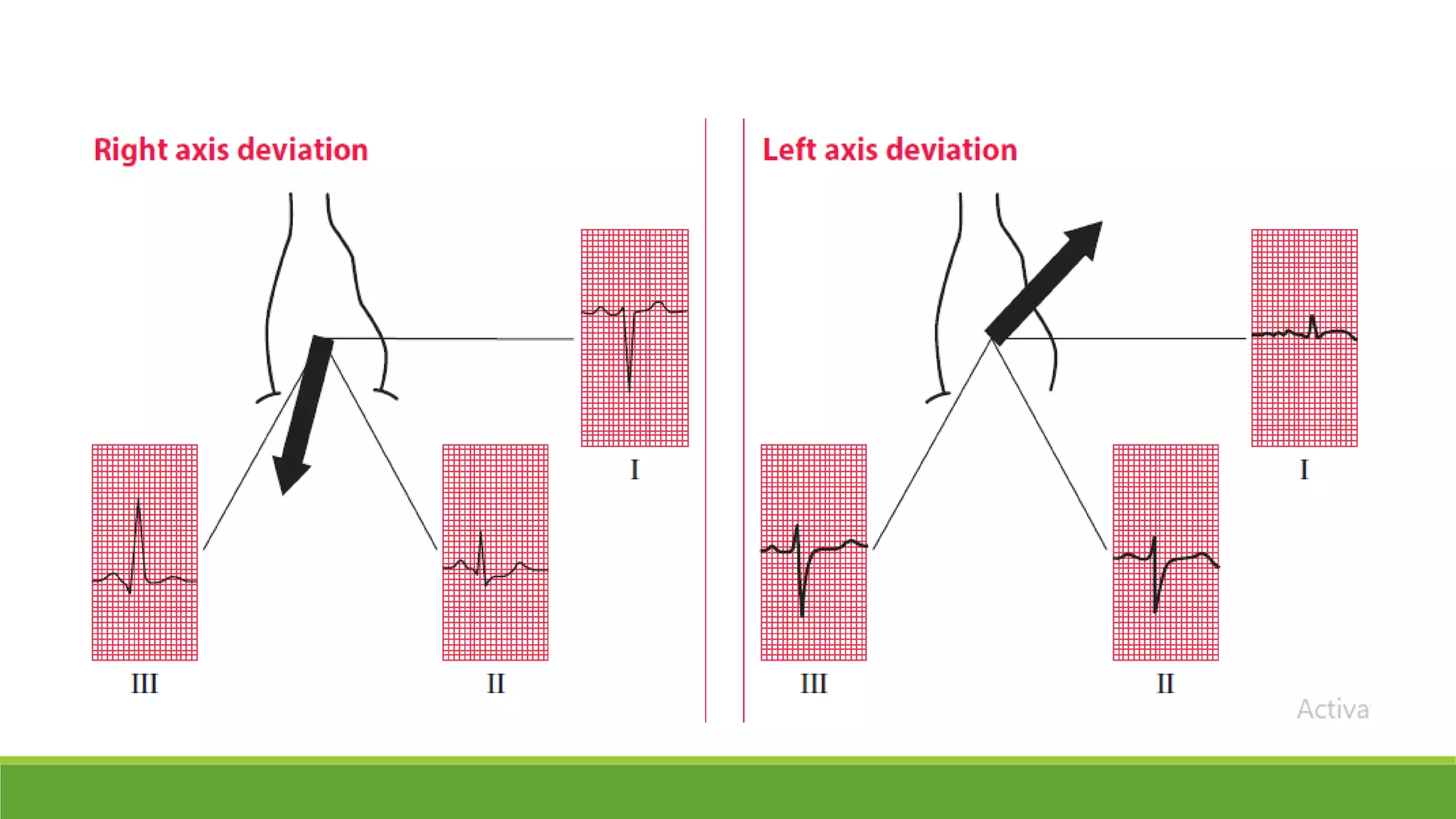 Basic ecg | PPTX