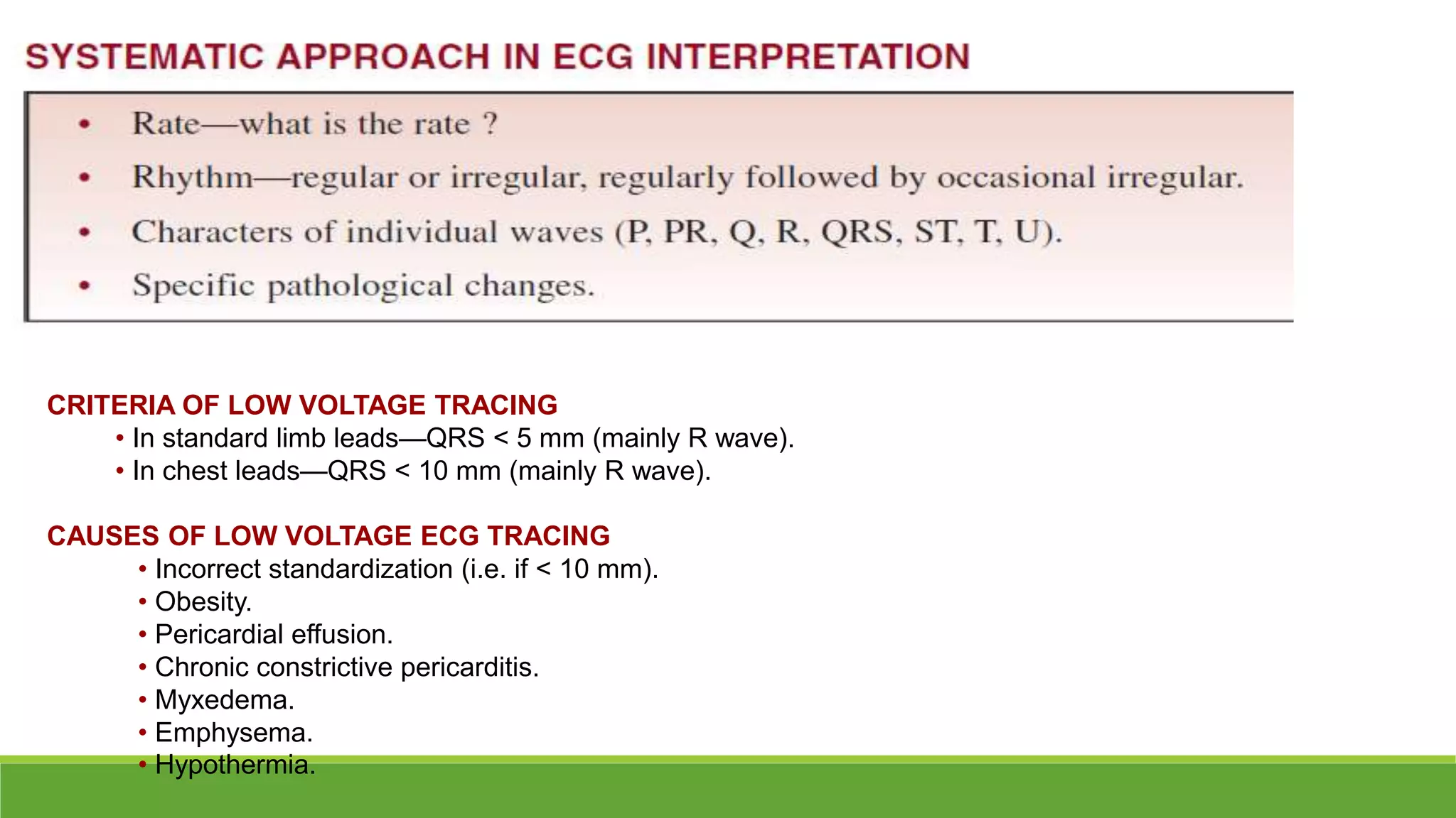 Basic ecg | PPTX