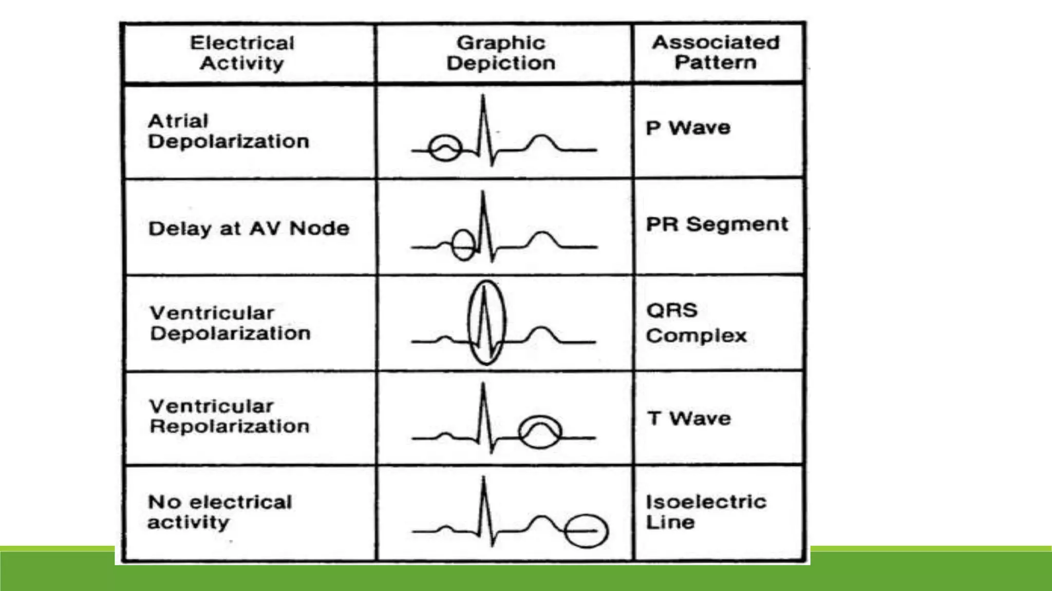 Basic ecg | PPTX