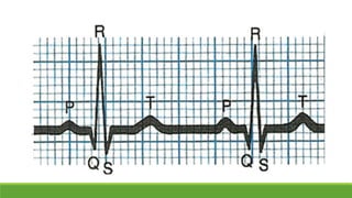 Basic ecg | PPTX