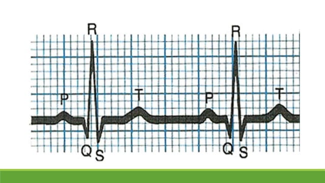 Basic ecg | PPTX