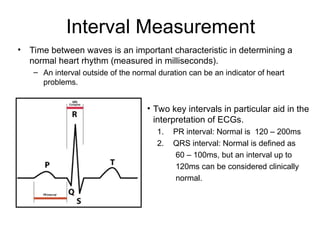 Basic ECG presentation, interval measurement, | PPT